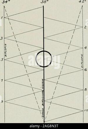 . Refraction and muscular imbalance, as simplified through the use of ...
