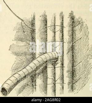 Modern surgery, general and operative . fastened to the stomachby one ...
