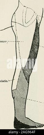 Muscles of the posterior leg, soleus and gastrocnemius muscle, photo of ...