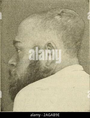 Modern surgery, general and operative . 7. Opening the Sheath for ...