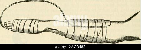 Modern surgery, general and operative . s made from the carpometacarpal ...
