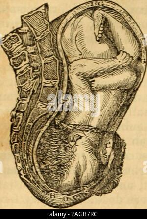 . The principles and practice of obstetricy, as at present taught, by ...