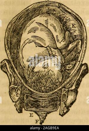 . The principles and practice of obstetricy, as at present taught, by ...