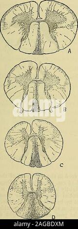 A manual of diseases of the nervous system . Fia. 16.>. ^24L^. Fig. 167 ...