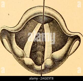 . A manual of diseases of the nose and throat. Paralysis of the left ...
