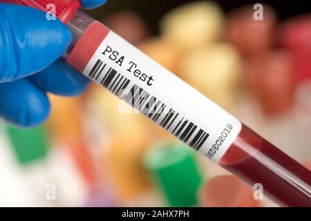 Prostate-specific antigen test Stock Photo - Alamy