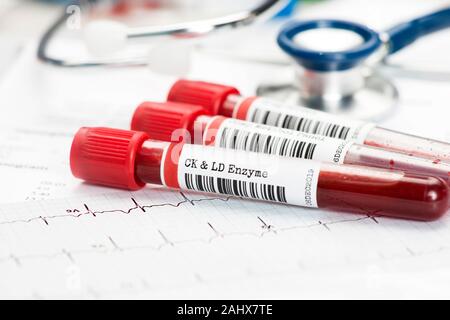 Cardiac Marker - Test with blood sample. Top view isolated on black ...