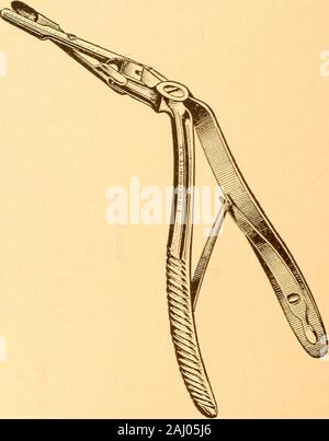 A manual of diseases of the nose and throat . of cartilage and bone ...