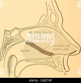 A manual of diseases of the nose and throat . of cartilage and bone ...