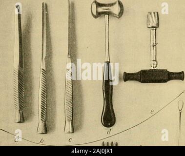 Operative surgery . OPERATIONS ON THE NERVOUS SYSTEM. 237. Trephining ...