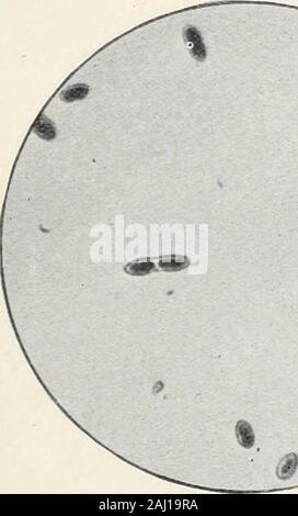 Mt Sinai Hospital Reports . Fig 6 Papillary carcinoma, showing atypical ...