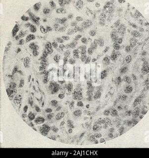 Mt Sinai Hospital Reports . Fig. 1 Stock Photo - Alamy