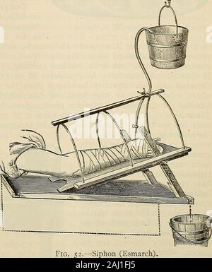 . Modern surgery, general and operative. Various forms of appendicitis ...