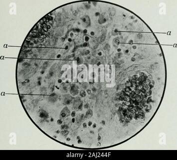 Pituitary blood test Stock Photo - Alamy