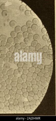 White blood cells observed under a microscope at the Troop Medical ...