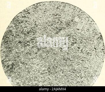 The Medical clinics of North America . ? Fig. 110.—Liver, showing ...