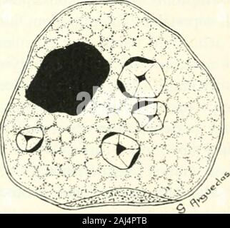 The Medical clinics of North America . Fig. 94.—Giardia intestinalis ...
