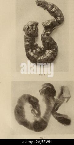 Interstate medical journal . he original plates in thelight of added ...
