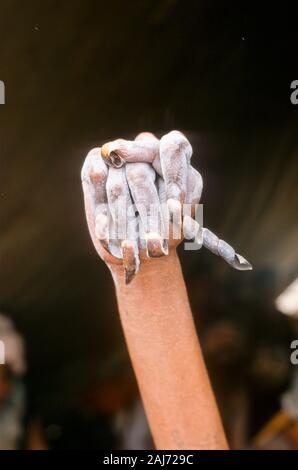 Sadhu practicing the Amar Bharti Tapa, raising his arm for 12 or more ...