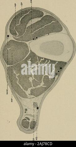 Surgical and obstetrical operations . Pirate XXXII.Anterior Tibiai ...
