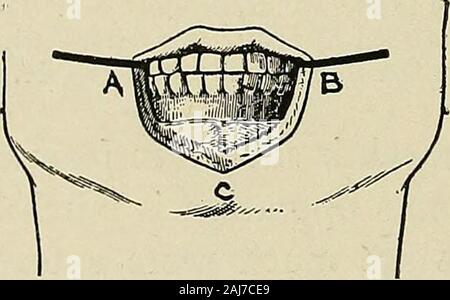 Plastic surgery; its principles and practice . d 2. The dark line ...