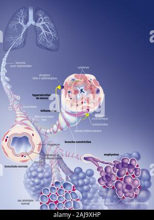 Lung pulmonary alveoli or alveolus anatomy diagram as a medical concept ...