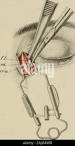 Plastic surgery; its principles and practice . / -f^/ M Fig. 811 ...