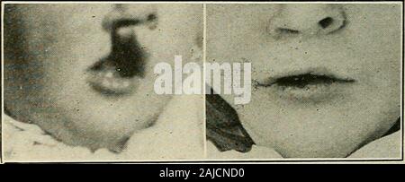 Plastic surgery; its principles and practice . been no tendency to ...