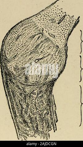 Development of bone in the place of the cartilage model. The growth ...