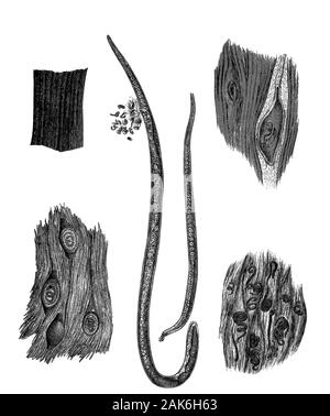 Muscle trichinae, woodcut from 1864 Stock Photo - Alamy