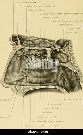 The anatomy and surgery of the frontal sinus and anterior ethmoidal ...
