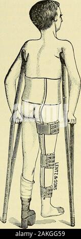 . Operative surgery, for students and practitioners . The patient lies ...