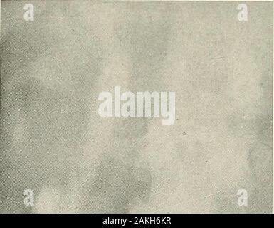 Pyelography (pyelo-ureterography) a study of the normal and pathologic ...