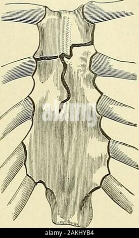 Operative surgery, for students and practitioners . t. The Outlines of ...