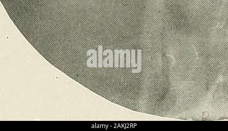 Pyelography (pyelo-ureterography) a study of the normal and pathologic ...