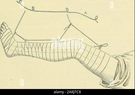 . A manual of operative surgery . Posterior posterior. FIG. 138 ...