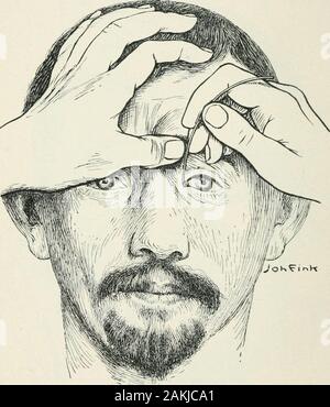 Atlas and epitome of operative ophthalmology . Fig. 133.—a ...