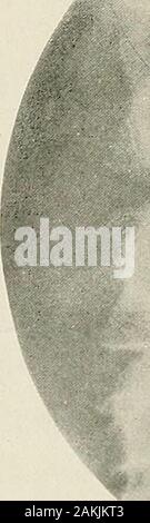 Pyelography (pyelo-ureterography) a study of the normal and pathologic ...