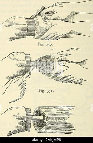 . Modern surgery, general and operative. the incision shown in Fig. 286 ...