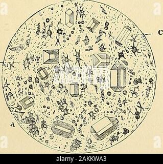 Syphilis is a dangerous disease Stock Photo - Alamy