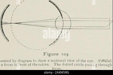 Ocular refraction and the shadow test . If the same experiment be made ...