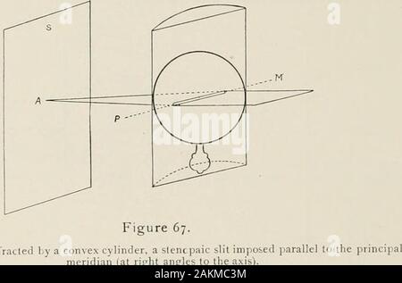 Ocular refraction and the shadow test . d II, figure 85 illustrates the ...