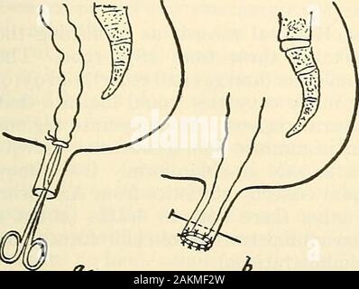 Operative surgery . being left free. Fromthree to five of these ...
