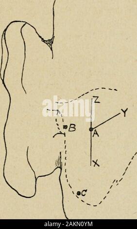 The Journal of laryngology and otology . anterior and inferior part of ...
