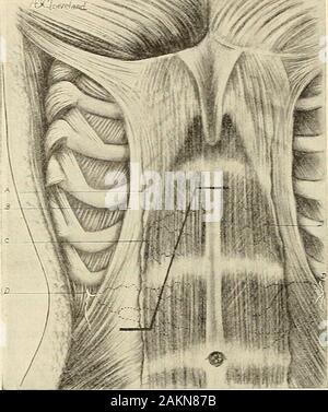 . Modern surgery, general and operative. the incision shown in Fig. 286 ...