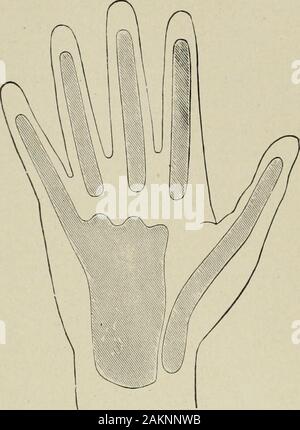 This section from Cunningham's anatomy textbook describes the knee-joint's structure, detailing ...