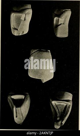 Principles and practice of operative dentistry . I. Simple Cavities ...
