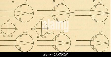 . The refraction of the eye; including a complete treatise on ...
