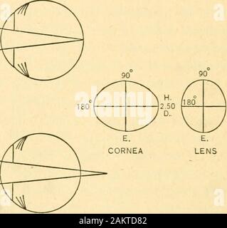 . The refraction of the eye; including a complete treatise on ...