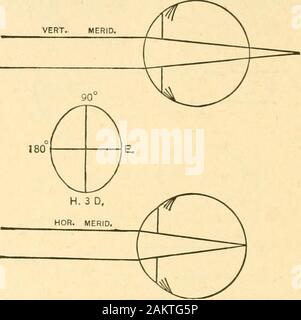 . The refraction of the eye; including a complete treatise on ...